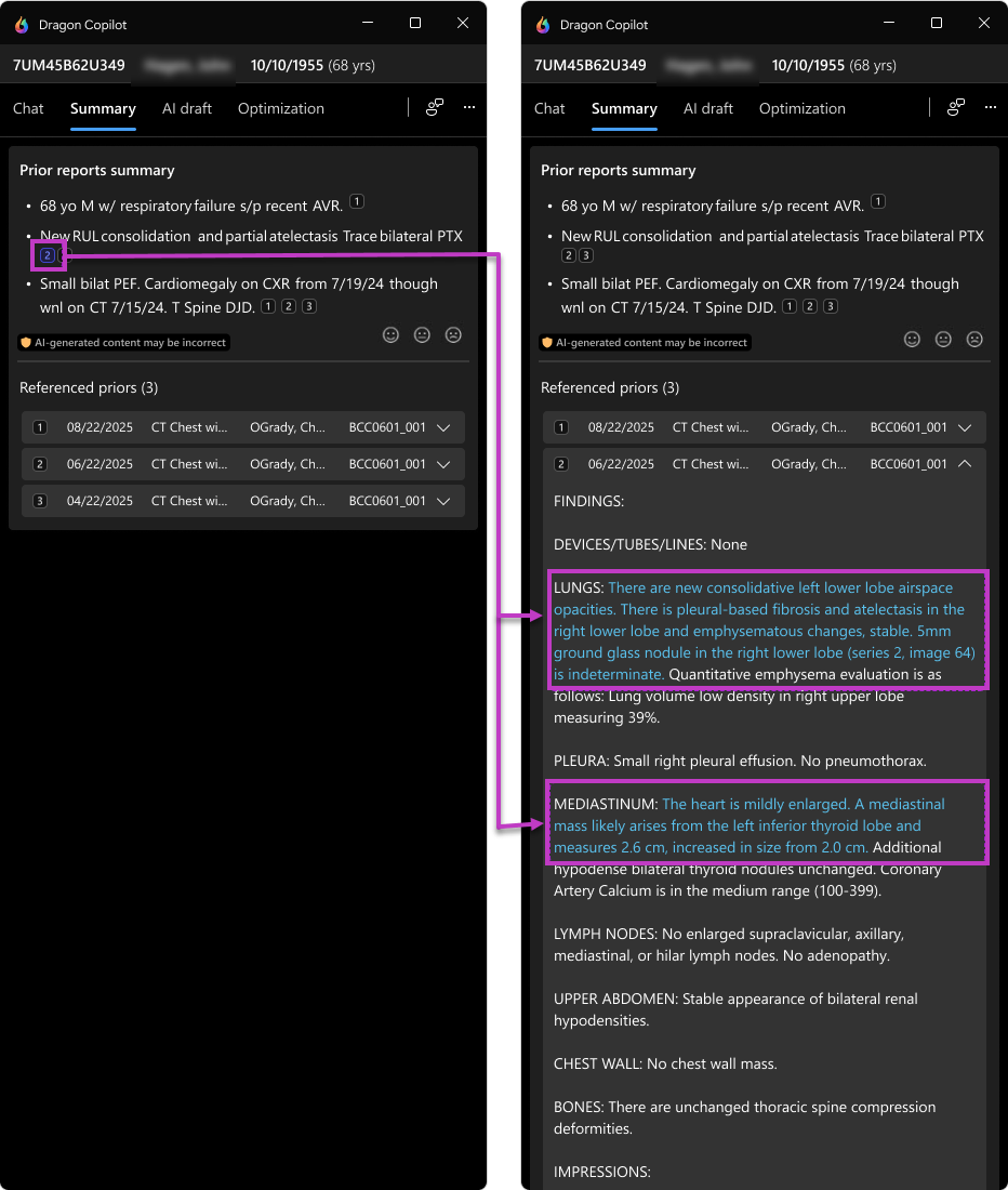 Summary in Dragon Copilot (radiologists) | Microsoft Support